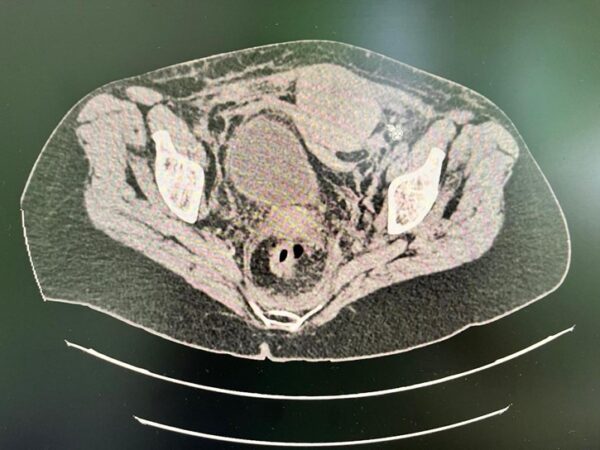 Physician case collaboration: How Sermo enhances patient care