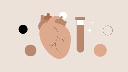 Lepodisiran Reviews: A New Cholesterol Drug Raising Big Questions